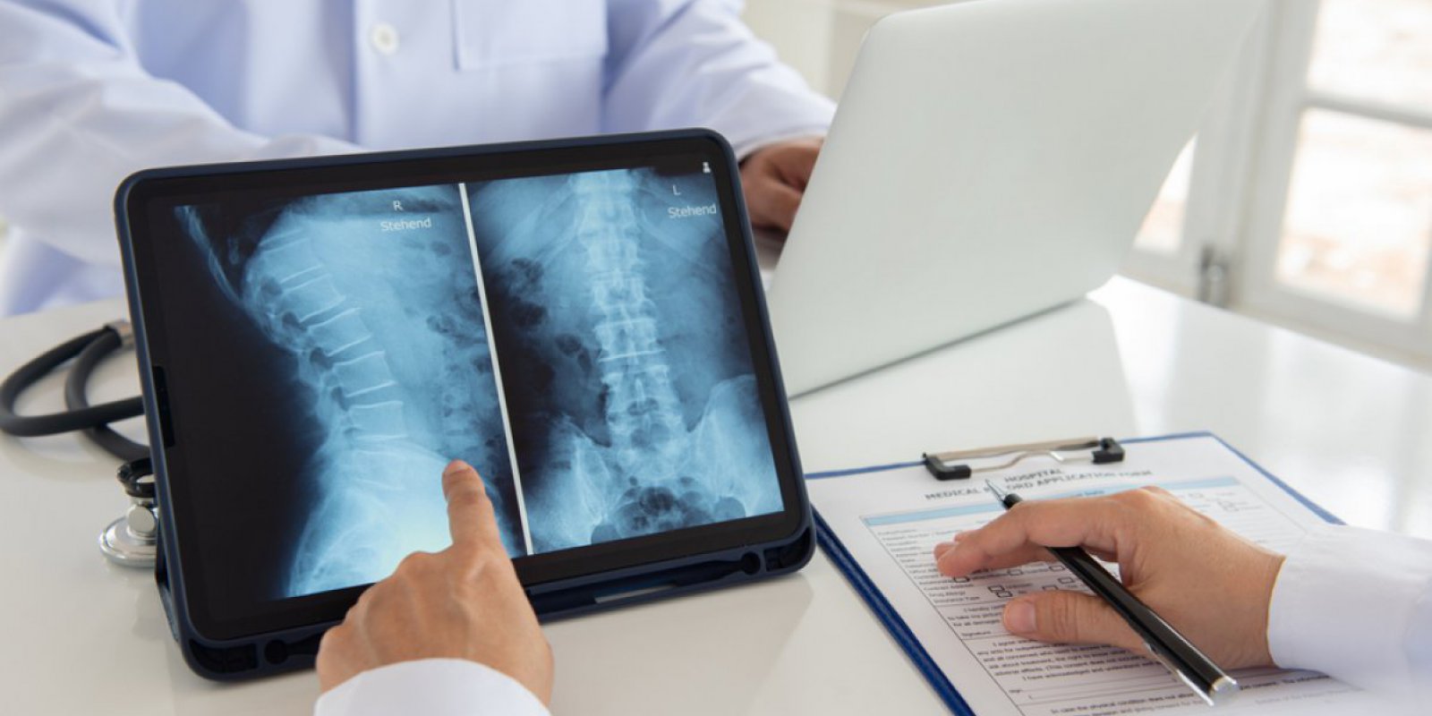 Behandeling van lumbale discushernia: open versus endoscopische ...